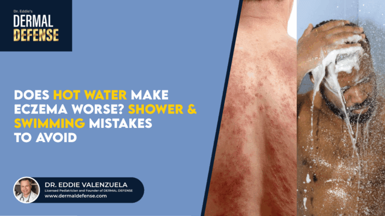 Hot Water & Eczema: Common Shower Mistakes - Dr.Eddie's Dermal Defense